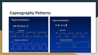 Capnography - Class Notes Slideshow | PPT