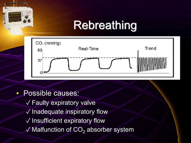 capnography and pulse oximetry the standard of respiratory care | PPTX ...