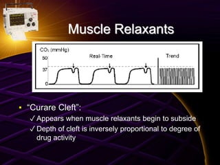 capnography and pulse oximetry the standard of respiratory care | PPTX