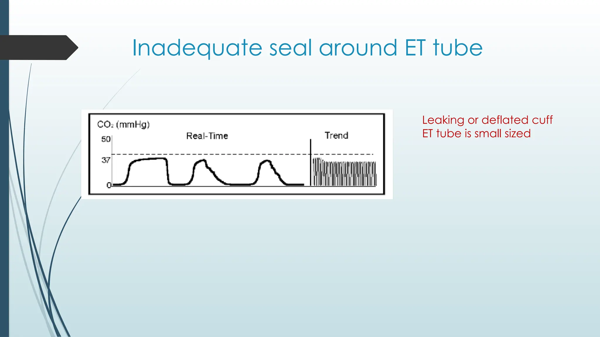 capnography intaoperative etco2 monitoring.pptx