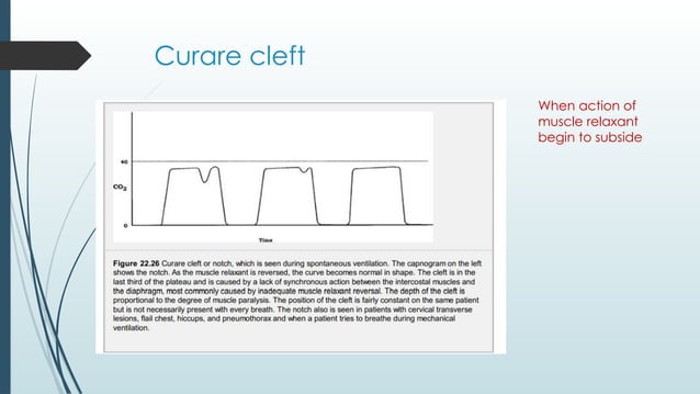 peri operative monitoring capnography.pptx