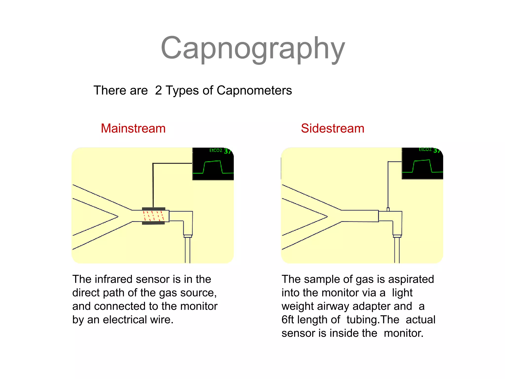 Capnography | PPTX