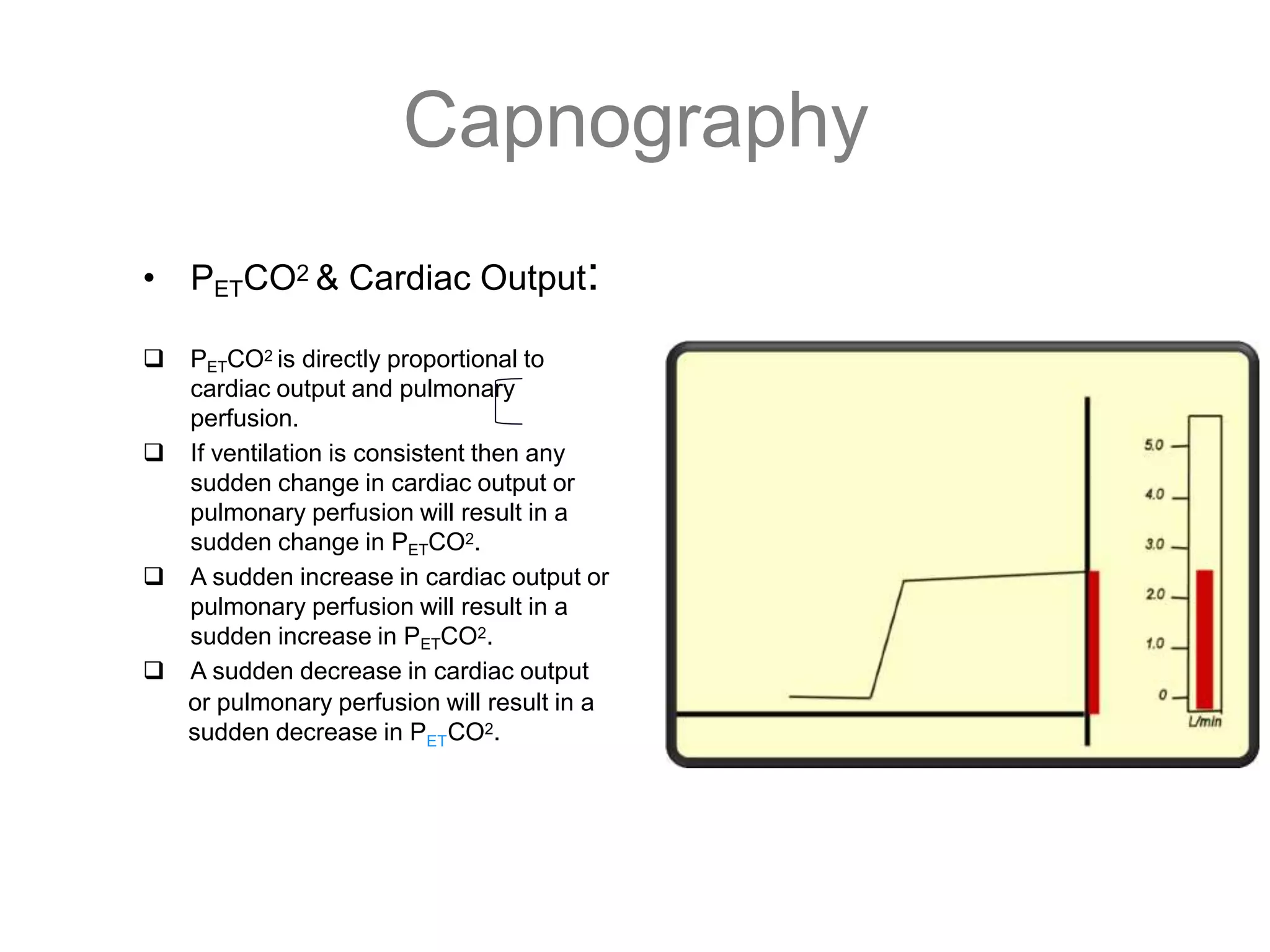 Capnography | PPTX