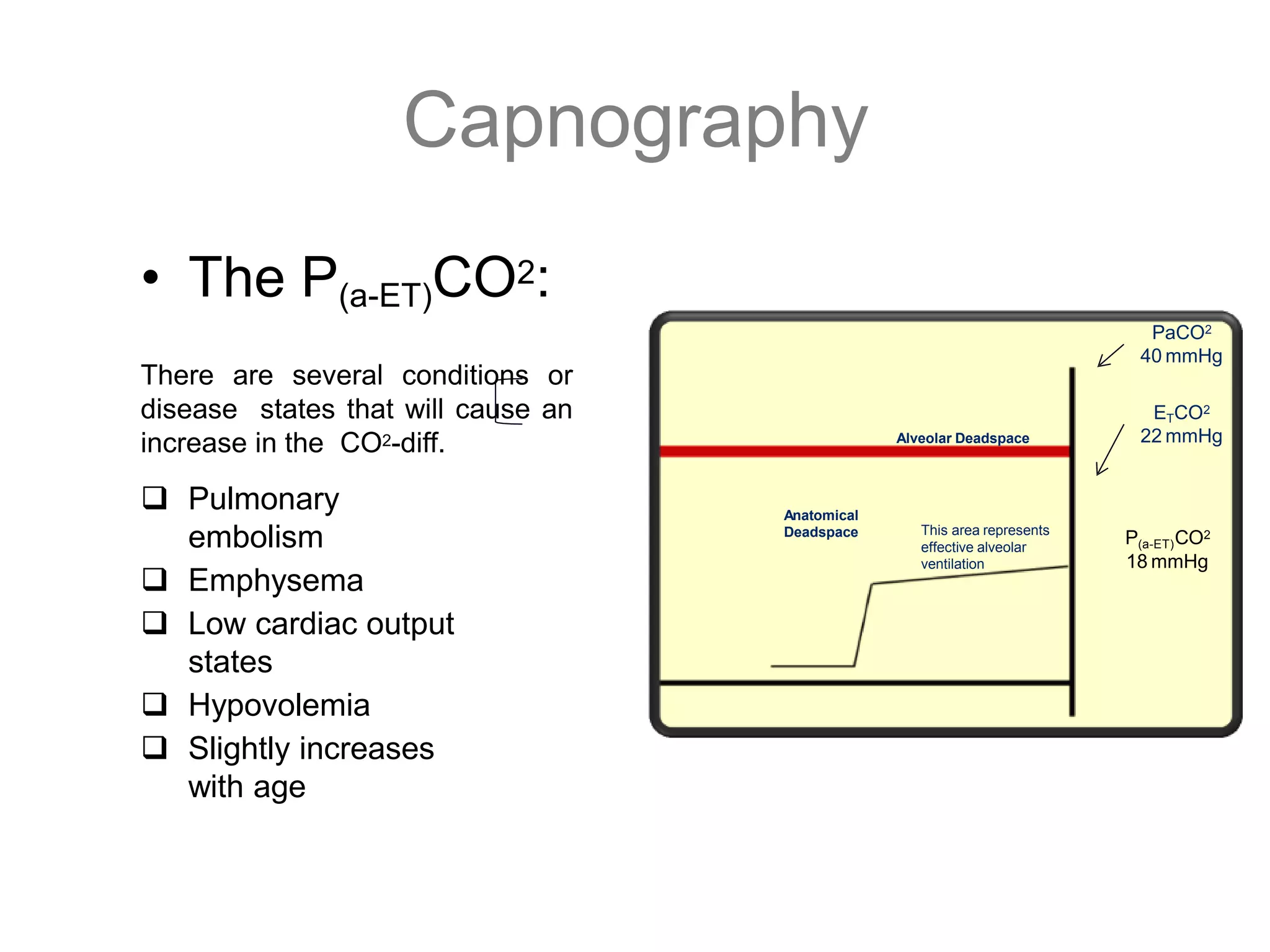 Capnography | PPTX