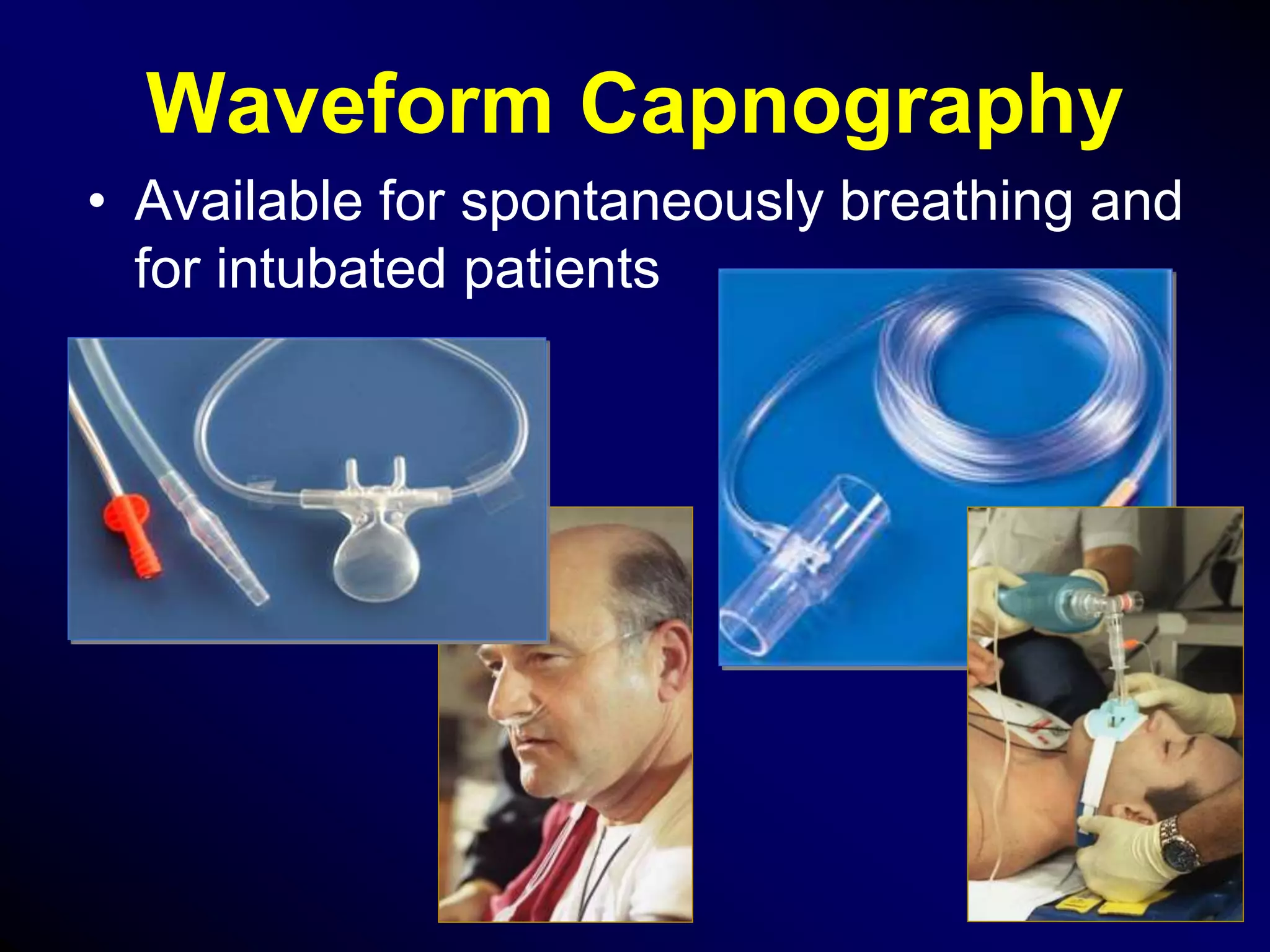 Capnography in icu | PPTX