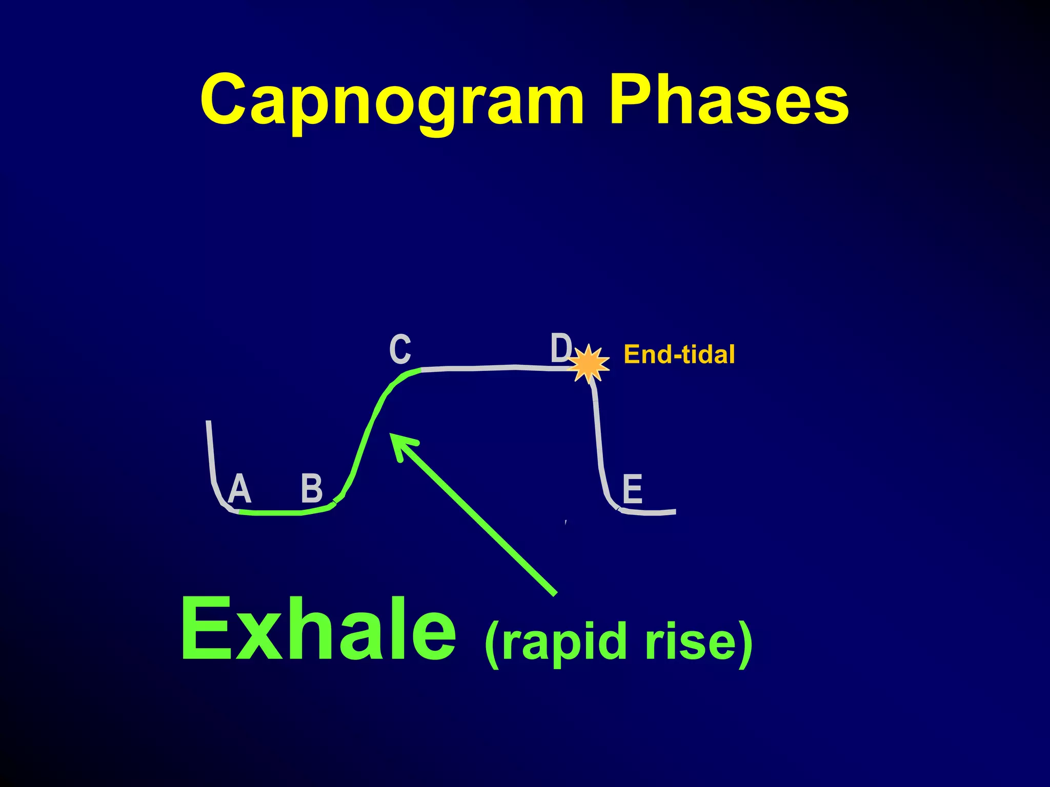 Capnography in icu | PPTX