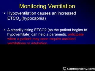 Capnography in icu | PPTX