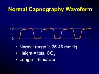 Capnography in icu | PPT