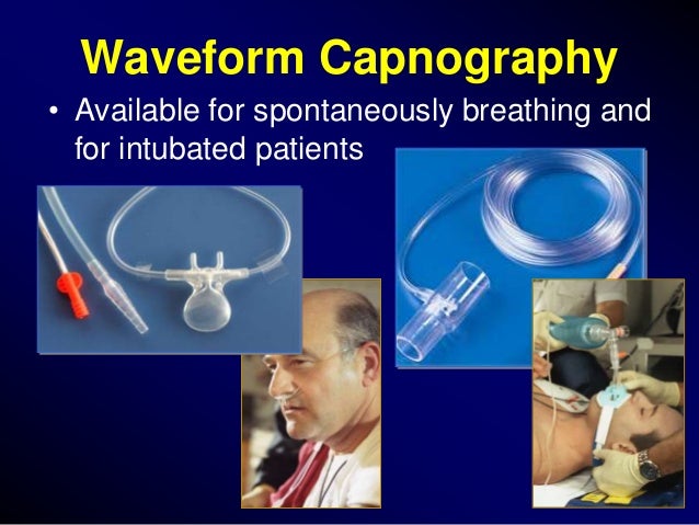 Capnography in icu