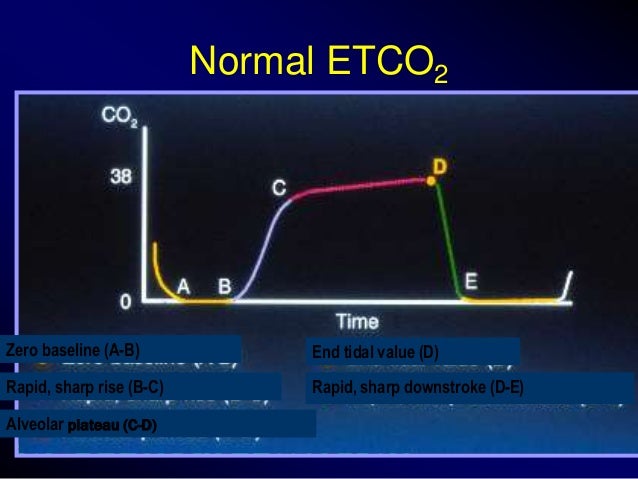Capnography in icu
