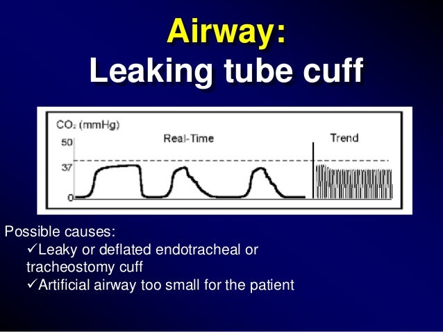 Capnography in icu