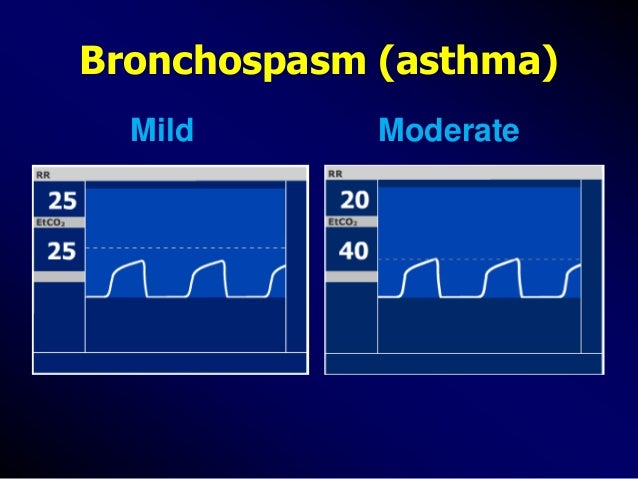 Capnography in icu