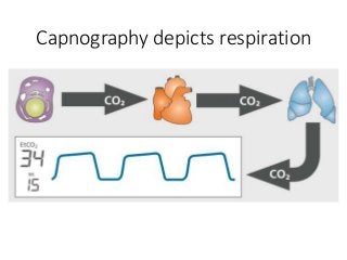 Capnography and interpretations | PPTX