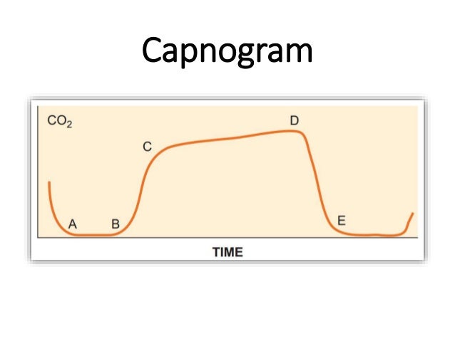 Capnography and interpretations | PPTX