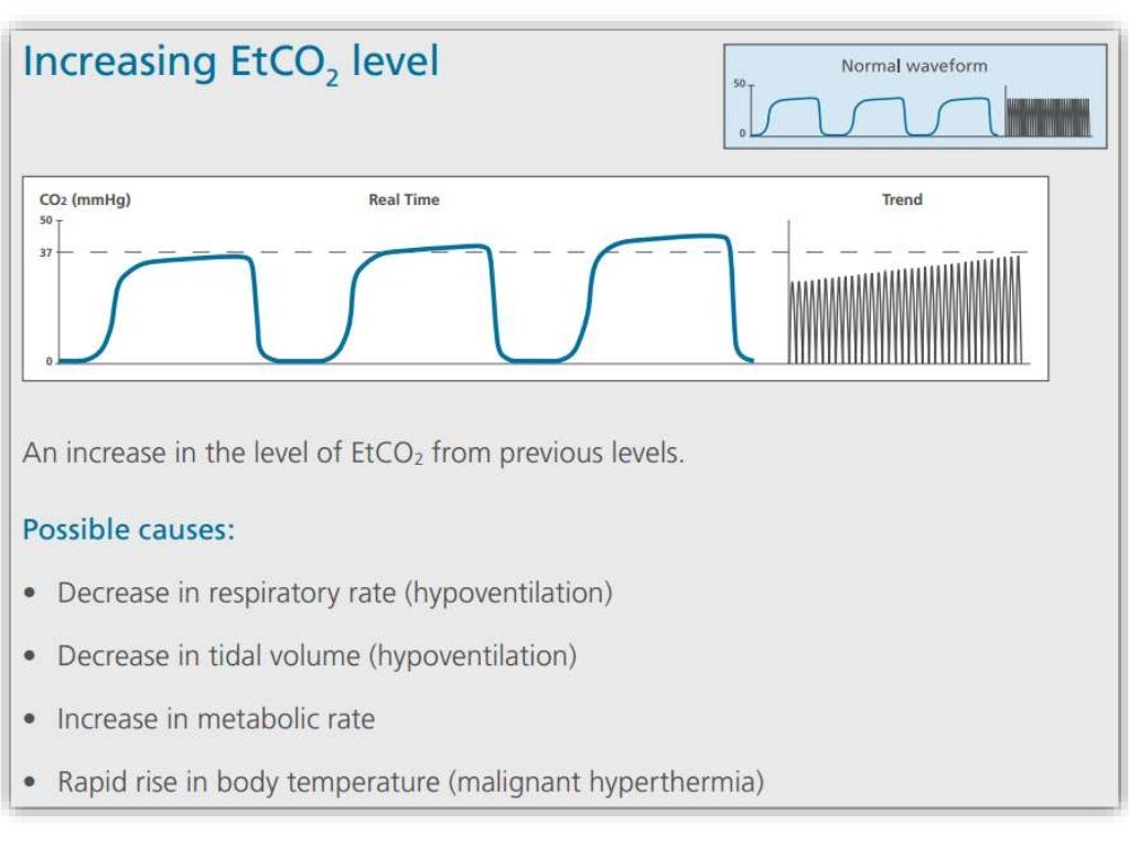 Capnography and interpretations | PPTX