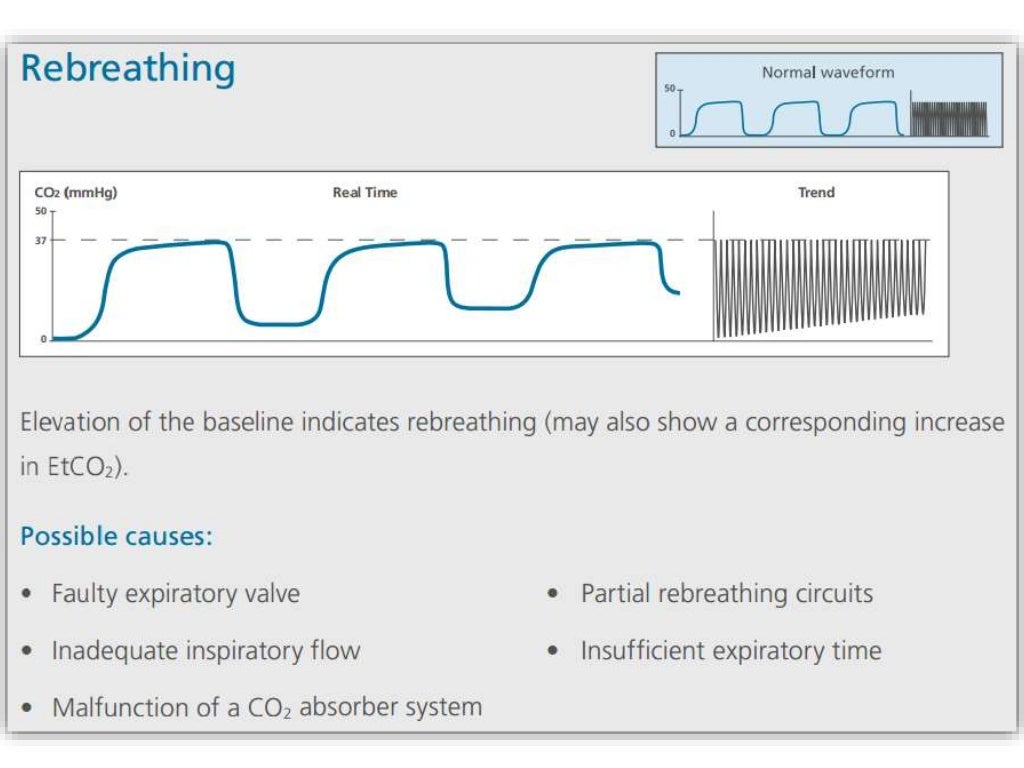 Capnography and interpretations | PPTX