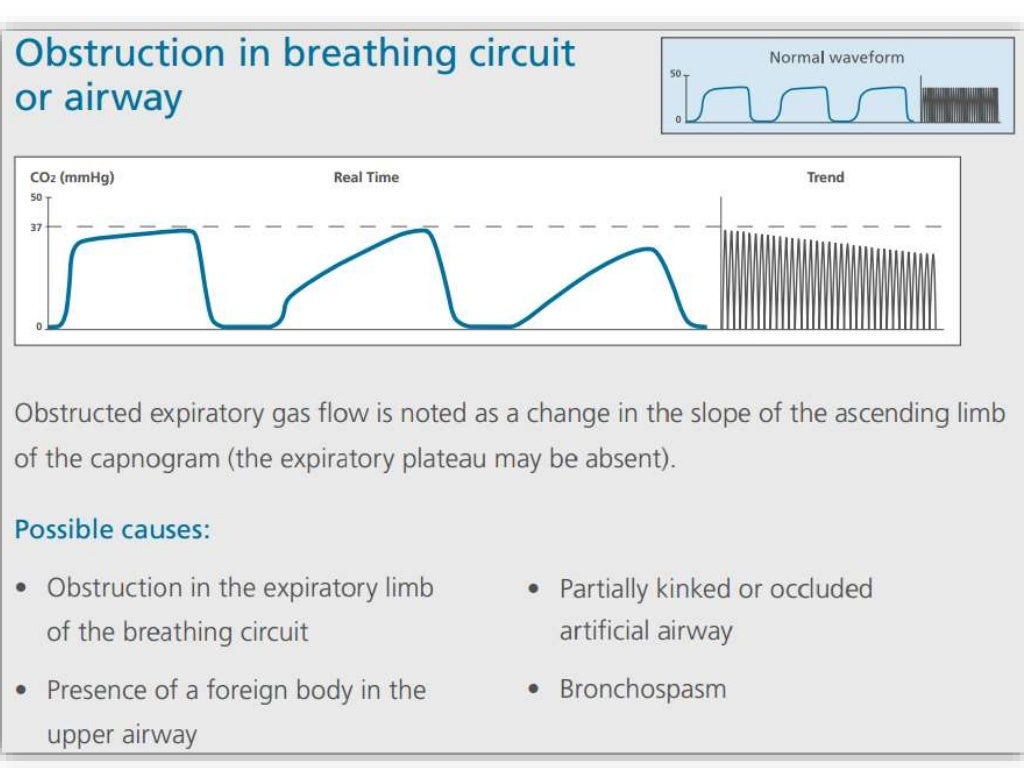 Capnography and interpretations | PPTX