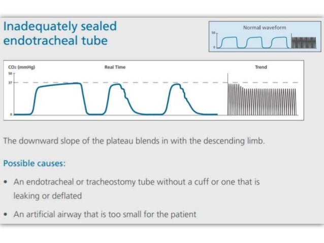 Capnography and interpretations | PPTX
