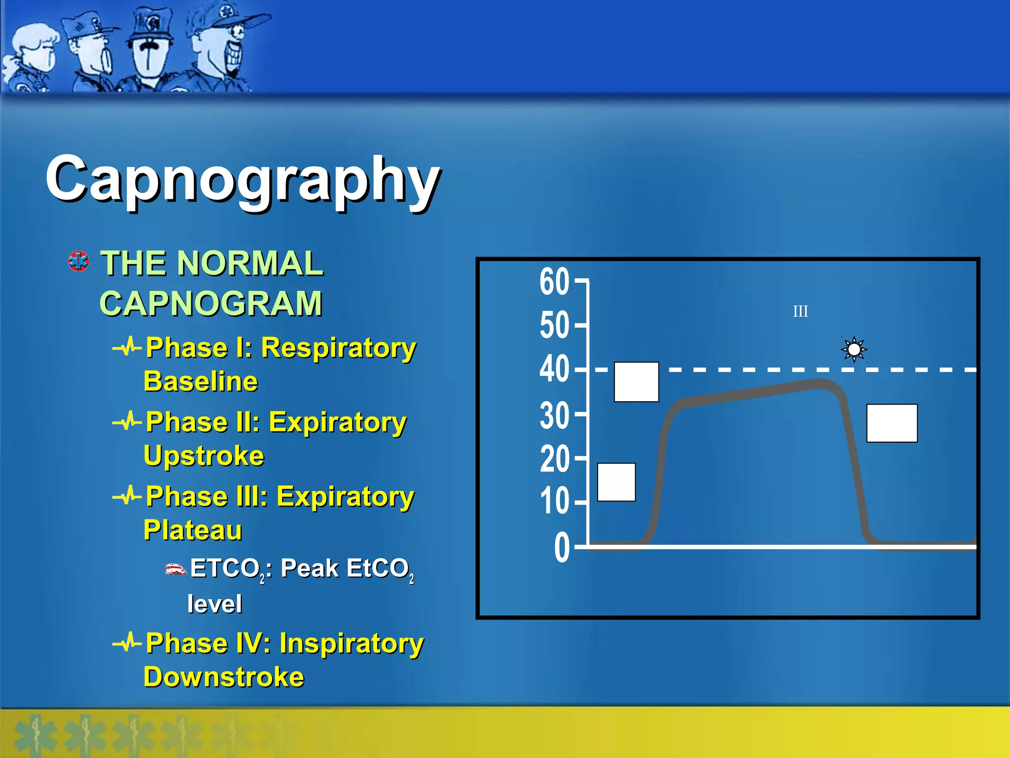 Capnography | PPT