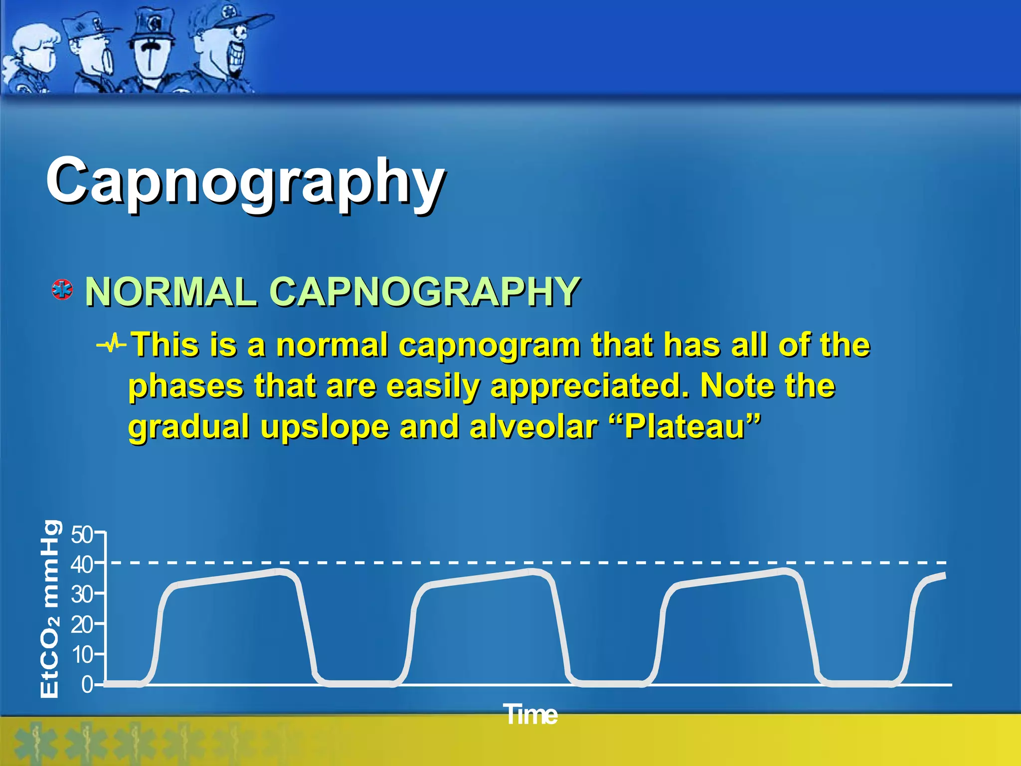 Capnography | PPT