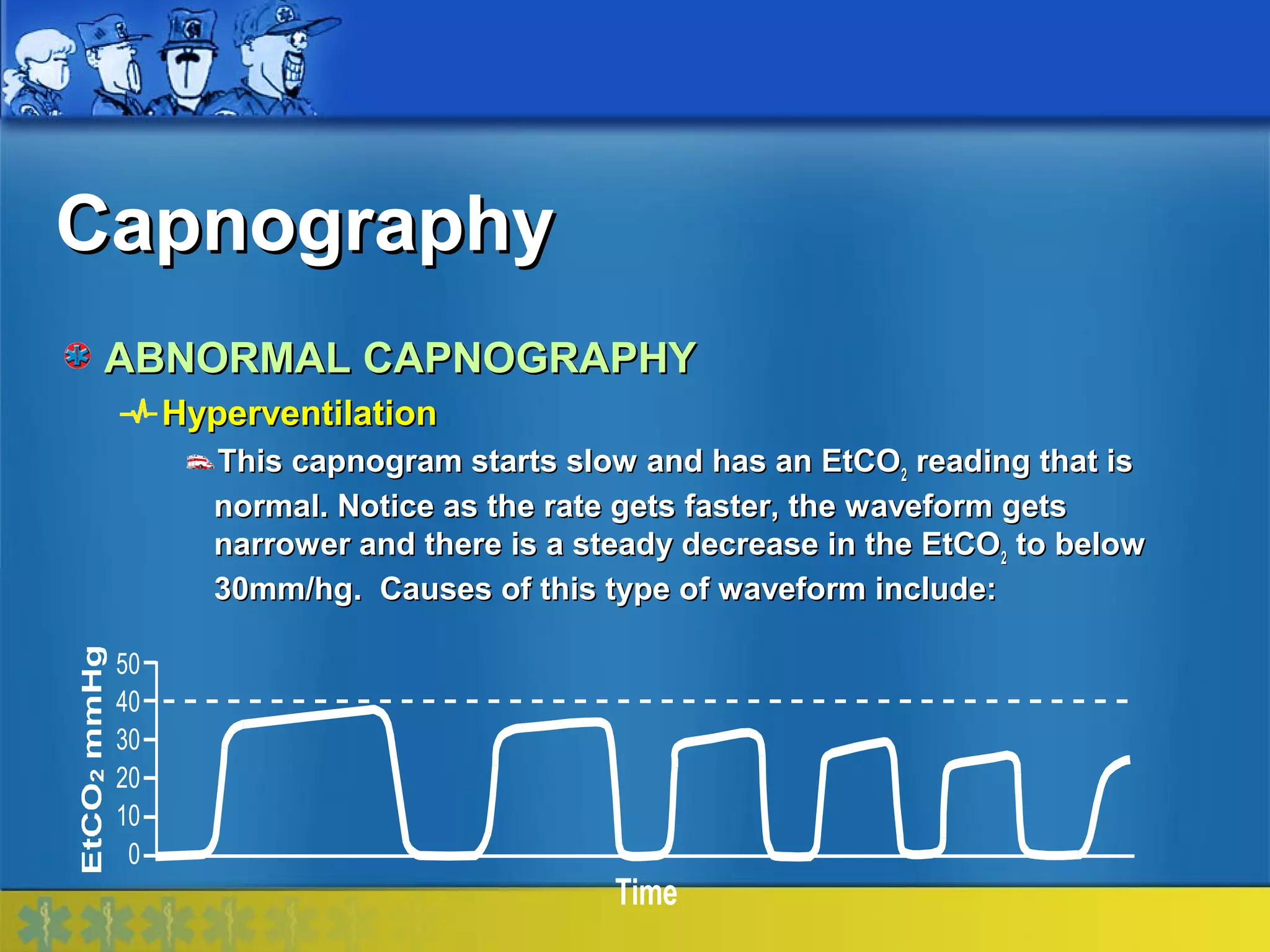Capnography | PPT