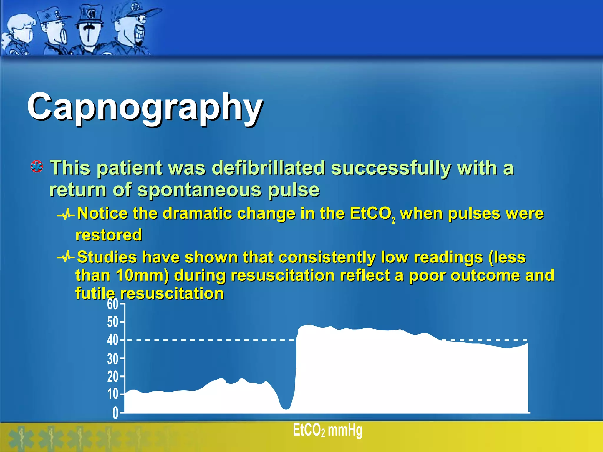 Capnography | PPT