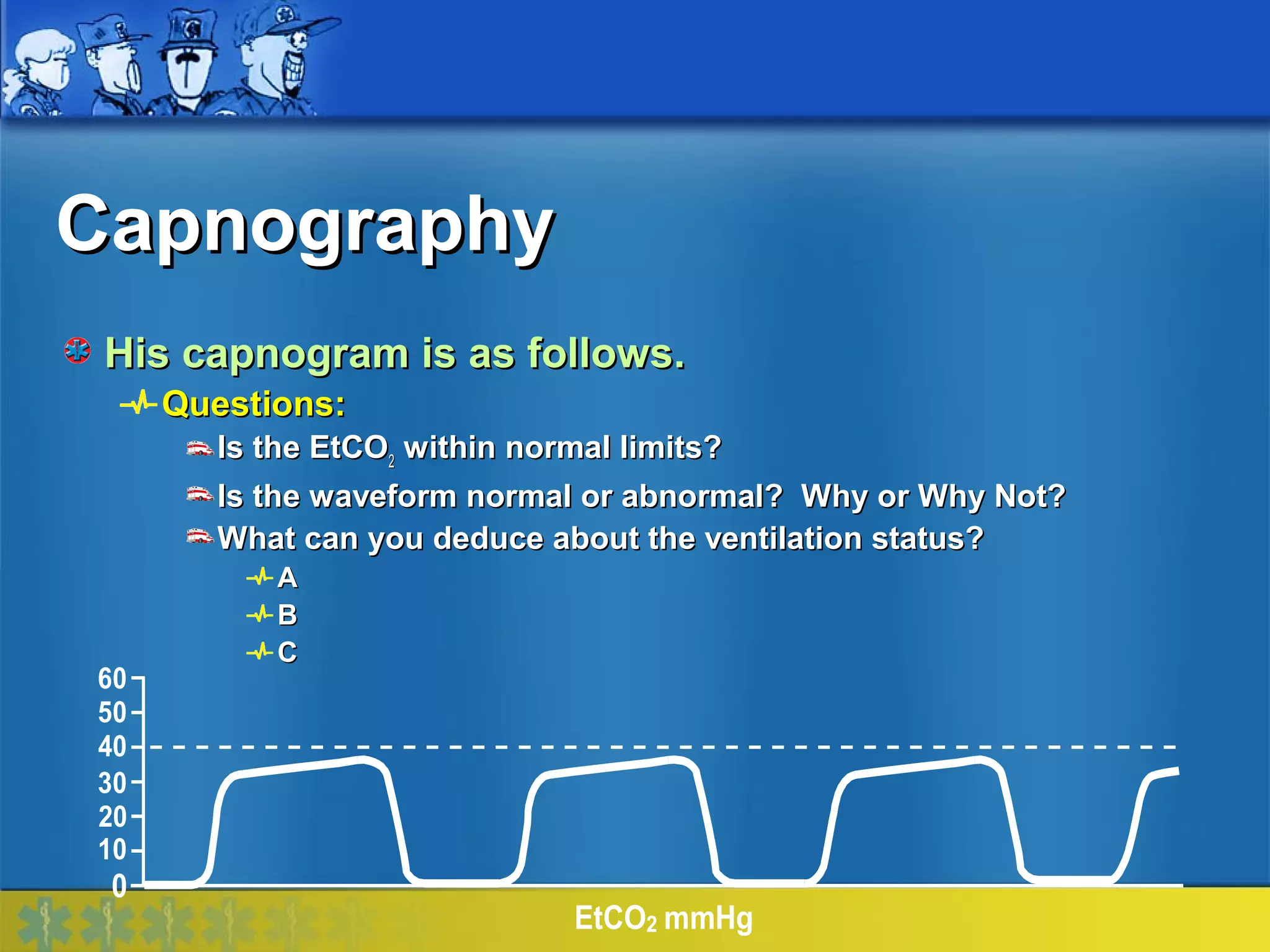 Capnography | PPT