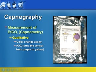Capnography | PPT