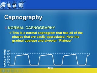 Capnography | PPT