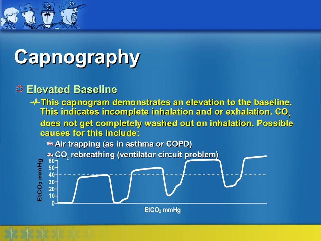 Capnography
