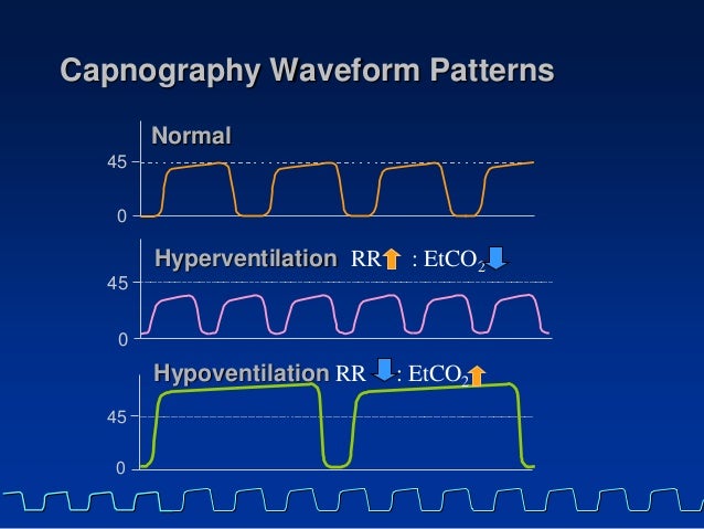 Capnography