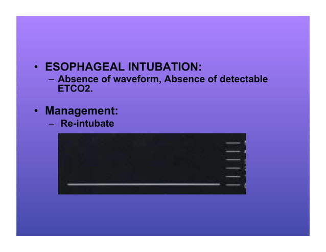 Capnography in ems.ppt | Lung and Respiratory Health | Diseases and ...