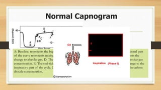 Capnography monitoring-PPT.pptx