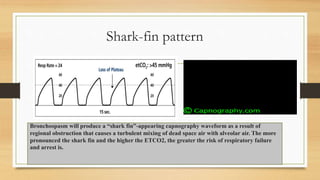 Capnography monitoring-PPT.pptx