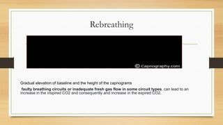 Capnography monitoring-PPT.pptx