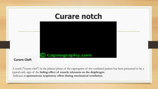 Capnography monitoring-PPT.pptx