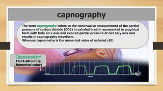 Capnography monitoring-PPT.pptx