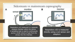 Capnography monitoring-PPT.pptx