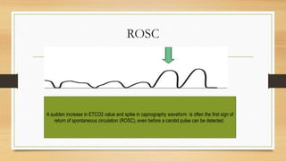 Capnography monitoring-PPT.pptx