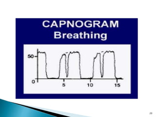 Capnography new | PPTX