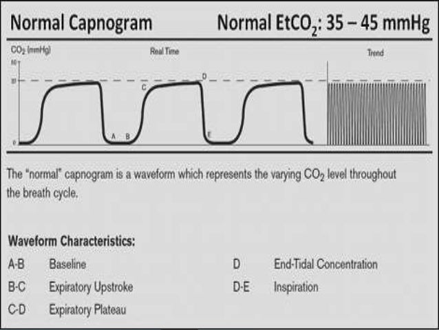 Normal range of capnography - bastalegal