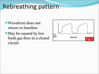 Capnonography explained for EMS | PPT