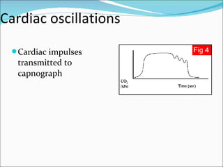 Capnonography explained for EMS | PPT