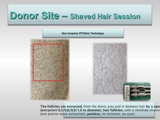 Capri presentation 2010 | PPT