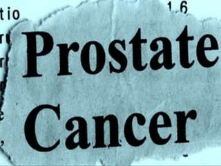 CA PROSTATE | PPTX | Cancer | Diseases and Conditions