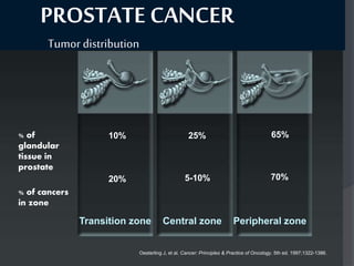 CA PROSTATE | PPTX