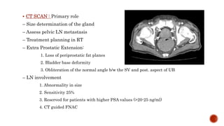 Carcinoma of prostate | PPTX