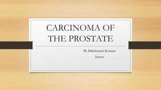 Ca Prostate.pptx
