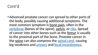 CA Prostate PowerPoint presentation surgery | PPTX