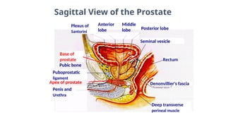 CA Prostate PowerPoint presentation surgery | PPTX